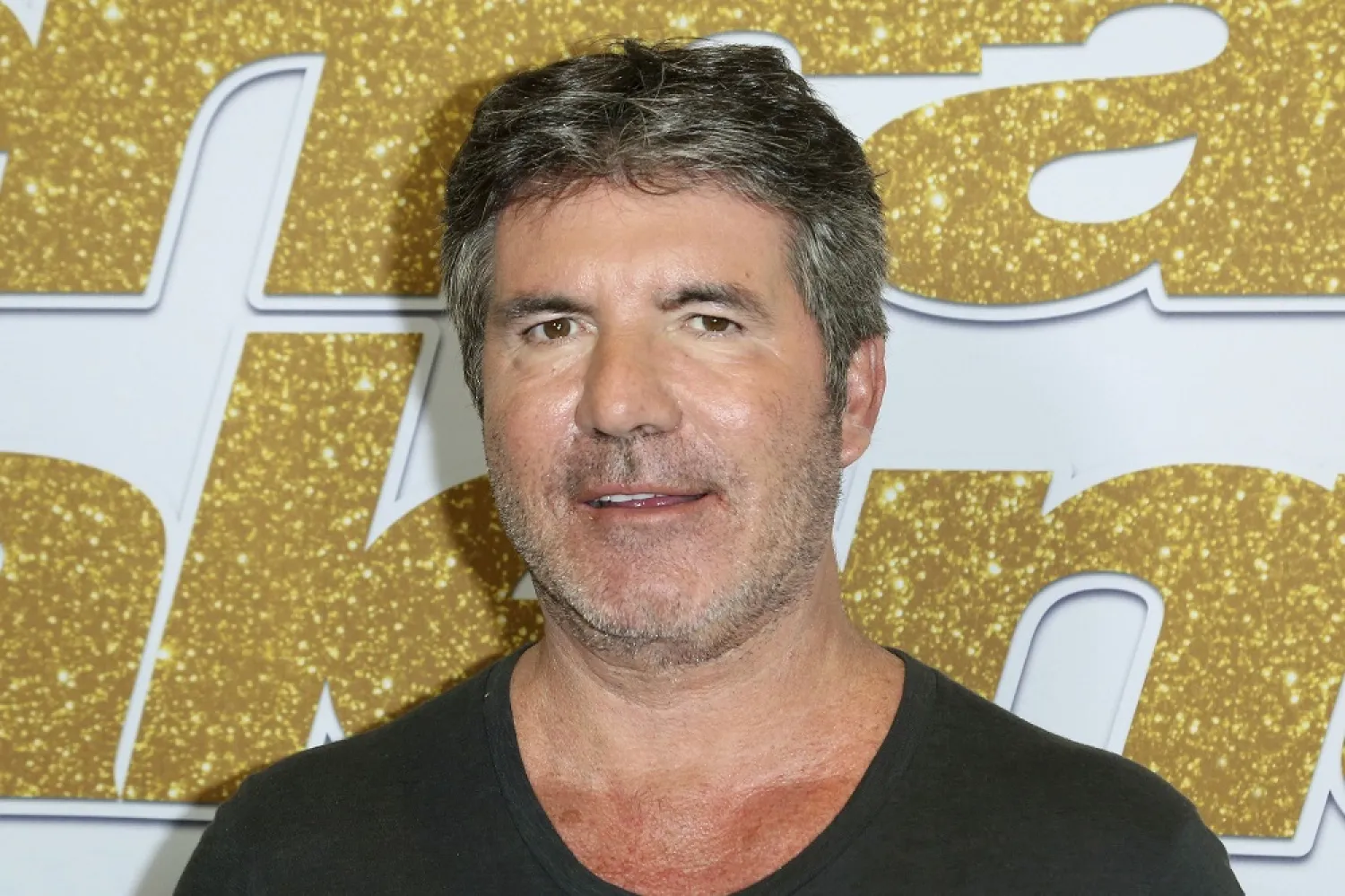 Simon Cowell Has Surgery for Broken Back after Bike Accident
