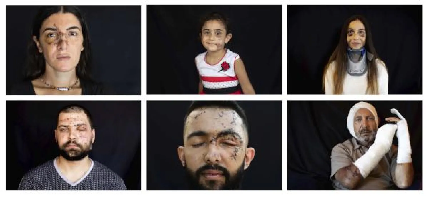 Scars From Beirut Blast Capture Moment of Horror