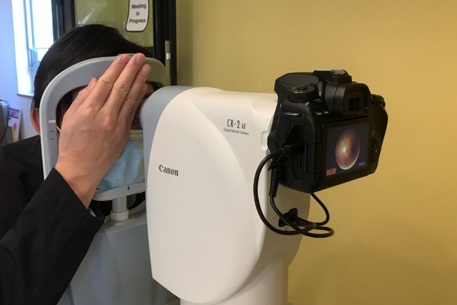 Scientist Uses Retinal Scan to Diagnose Autism