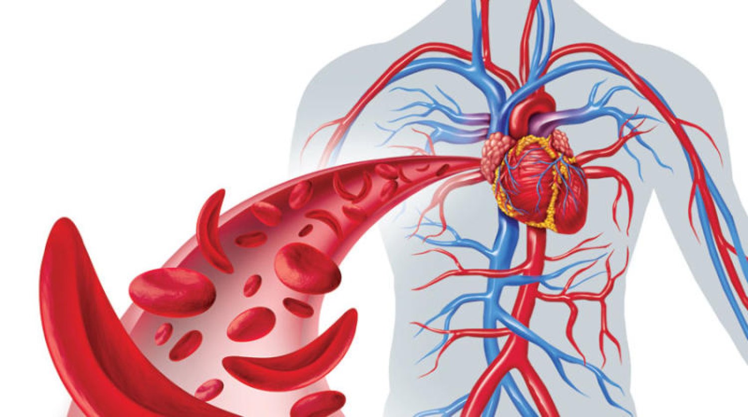 «الخلايا السمية الهدبية»... أحدث تطورات علاج فقر الدم المنجلي