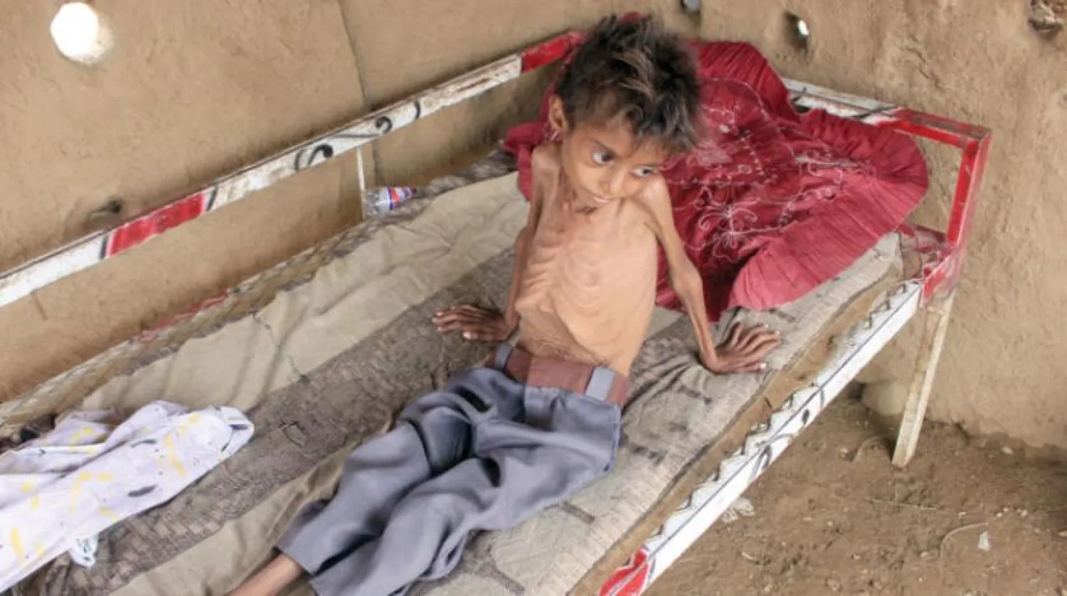 Yemenliler, Husiler tarafından açlığa sürüklenmelerinin ardından ...