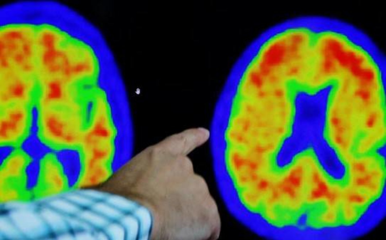 Bilim insanlarının beyin sağlığını korumak için uyguladıkları 5 şey