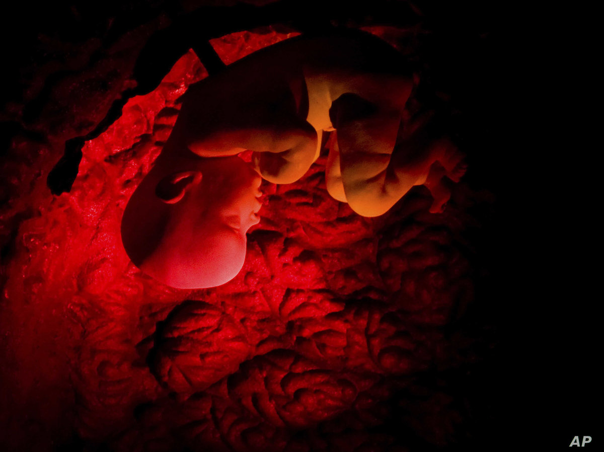 Scientists Create Model of Human Embryo to Study Early Abortion
