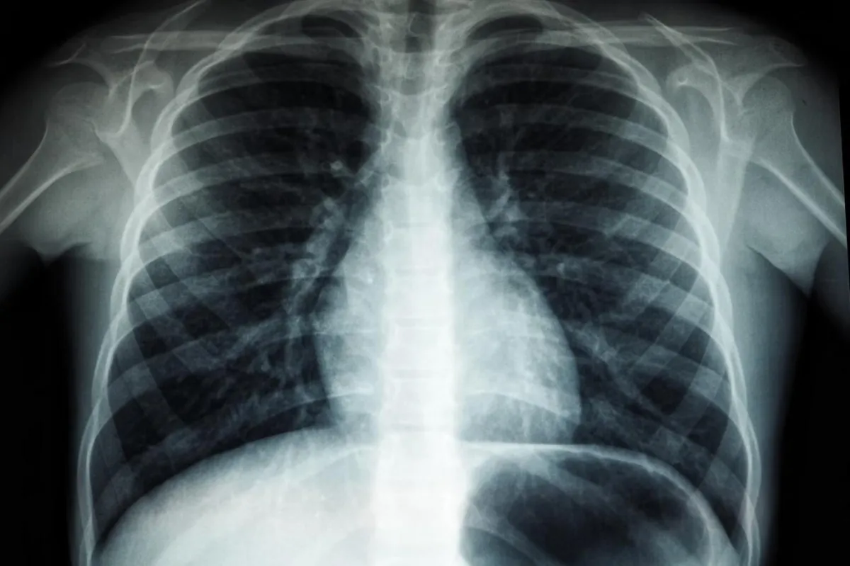 Doğurmanın kemik yapısını kalıcı olarak değiştirdiği ortaya çıktı