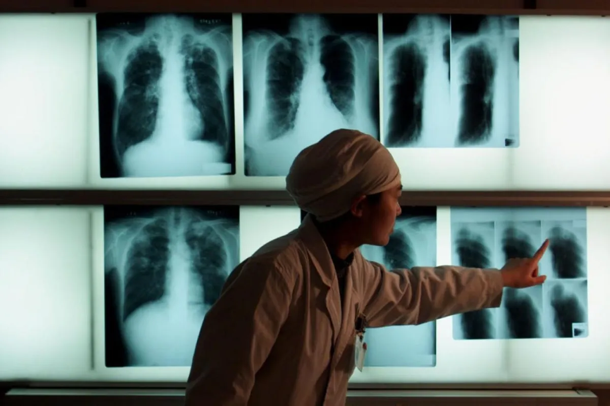 Verem tedavisini reddeden 42 yaşındaki hasta için tutuklama kararı ...