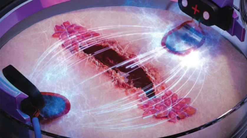 Elektrik, yaraları üç kat daha hızlı iyileştiriyor